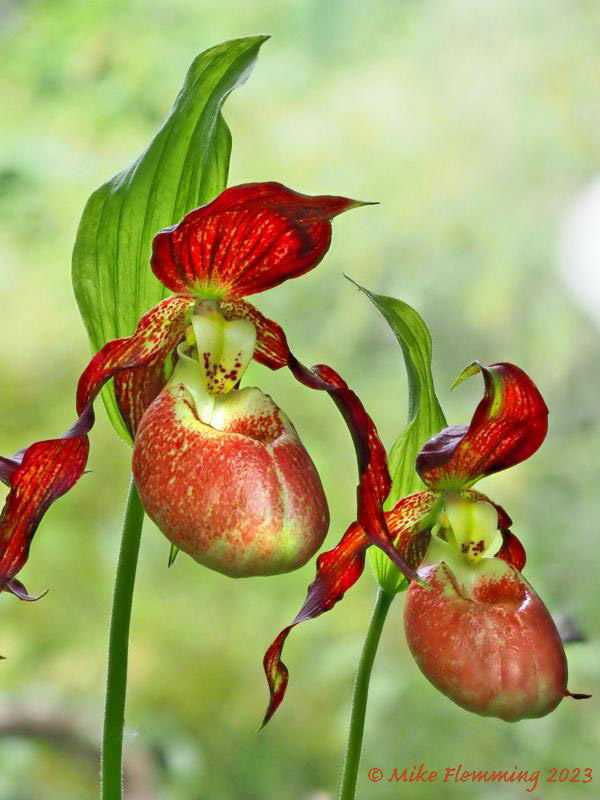 I had never heard of folate deficiency anemia until I got it. – How my ...